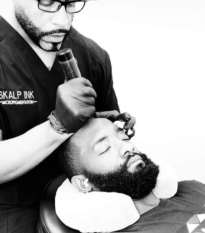 Top 10 Benefits of Scalp Ink Micropigmentation for Hair Loss - Skalp ...