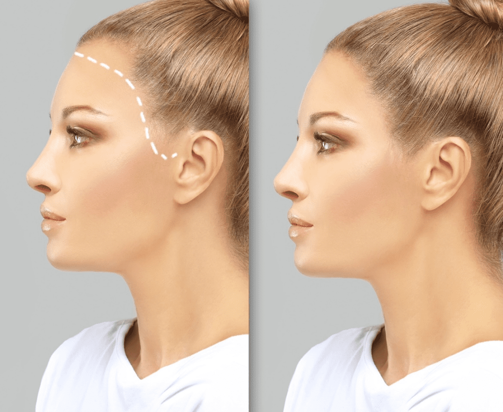 Is Scalp Ink Micropigmentation Right for You? A Comprehensive Checklist ...